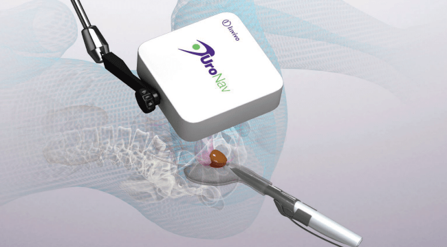 UroNav Fusion Biopsy for Prostate Cancer | Greater Boston Urology