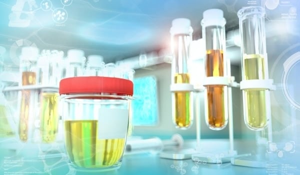 Understanding Hematuria | Greater Boston Urology